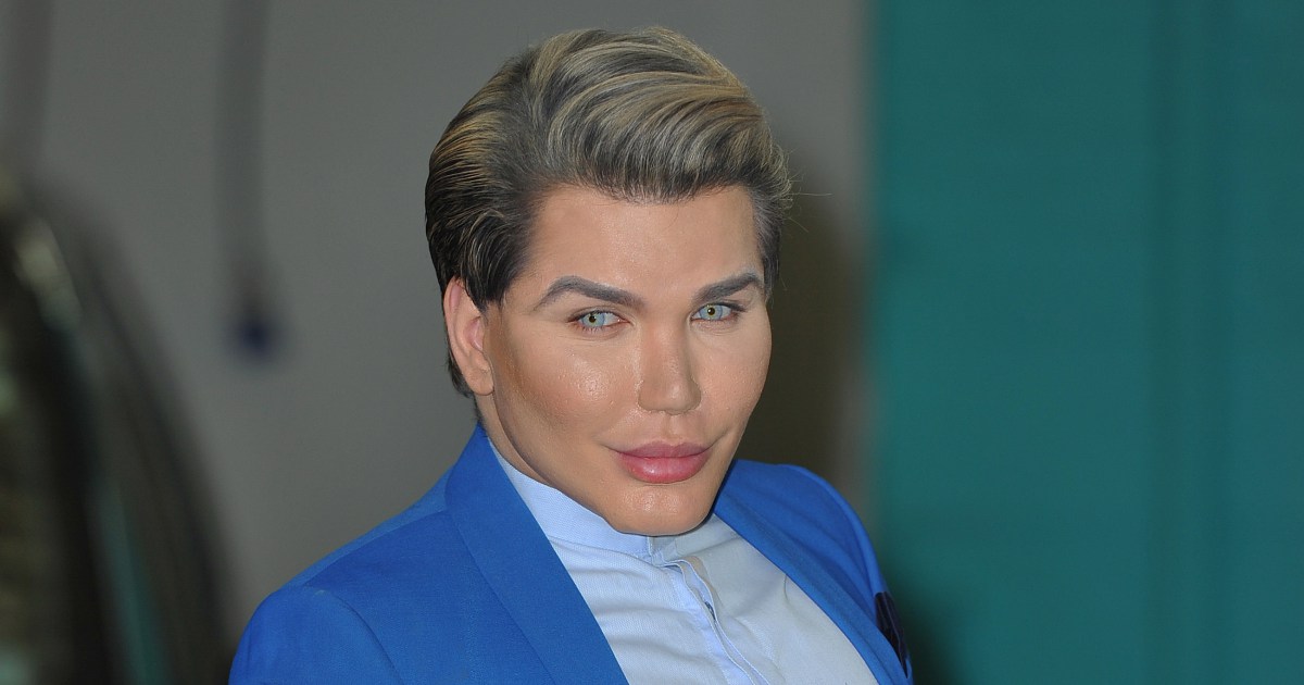 ¡No se aburre! «Ken humano» se realizó nueva cirugía — RadioActiva 92.5
