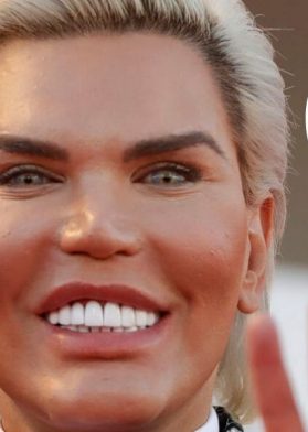 El "Ken humano" vuelve a su adicción y se inyecta placenta para lucir ...